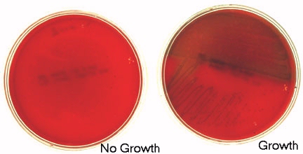 Haemophilus Isolation agar