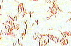 Gram Negative Flow Chart